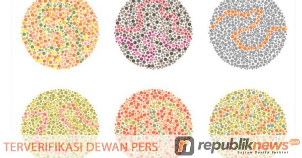 Mengenal Ciri-ciri Penderita Buta Warna Parsial